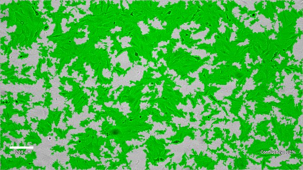 OP9-DL1 hDL-1-Expressing mOP9 Cell Line | SCC136